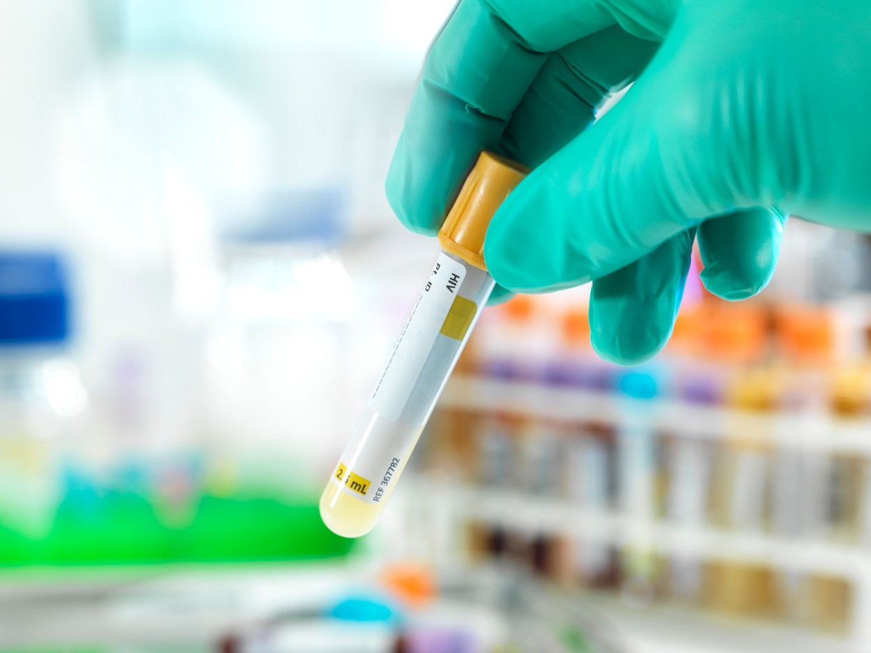 Primul tratament injectabil pentru HIV a primit undă verde de la ...