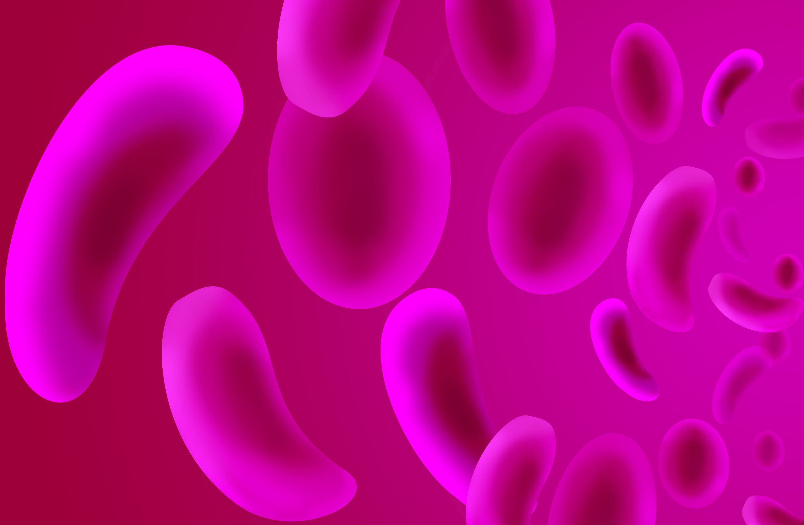 Siclemia: Care sunt primele simptome care indică faptul că o persoană ...